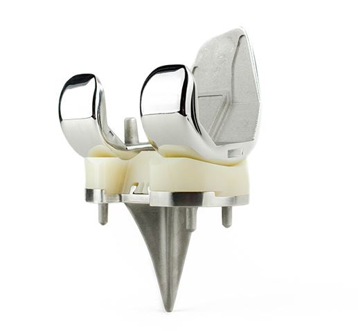 Consensus Knee System