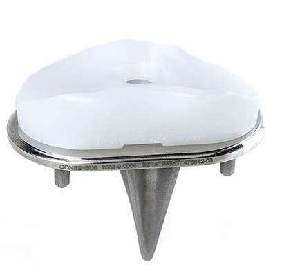 Consensus - Consensus Knee Systems - Mobile Bearing Knee ...