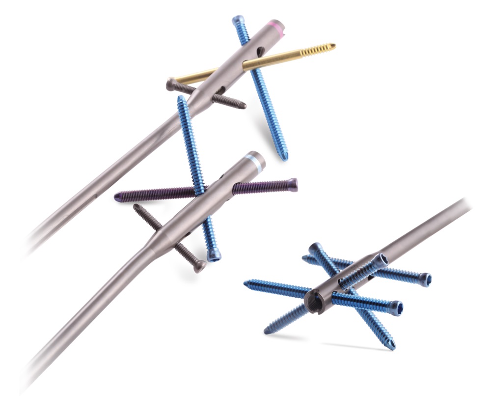 AOS - Magellan - Femoral Nail System By Advanced Orthopaedic ...