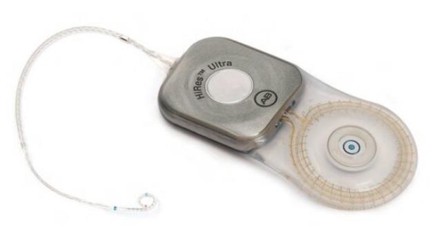 HiRes - Internal Parts of a Cochlear Implant - Cochlear ...
