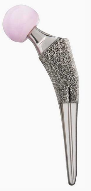 Alteon - Hip -Comprehensive Hip System - Tapered Wedge Stem ...