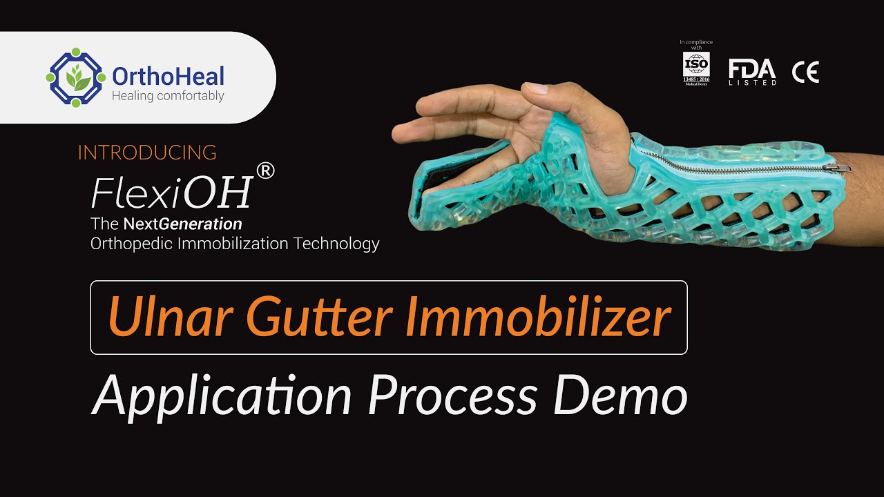 New Variant - FlexiOH Ulnar Gutter Immobilizer for finger fracture - Video