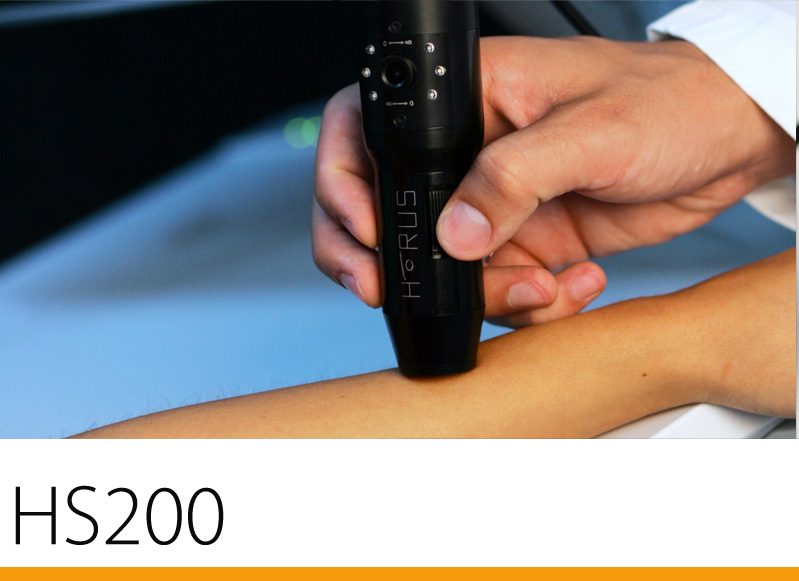 Horus Basic HS200 Transportable System For Videodermatoscopy And ...