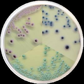 Condalab 2207 Candida Chromogenic Agar