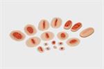 WK100 Adult Emergency Wound Kit