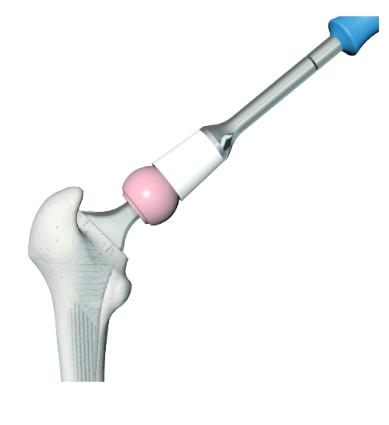 EasyHip - E-900 - Hip Replacement - Ceramic & CoCr Heads by ...