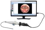 Optim VidCap USB Camera for ENT Endoscopy