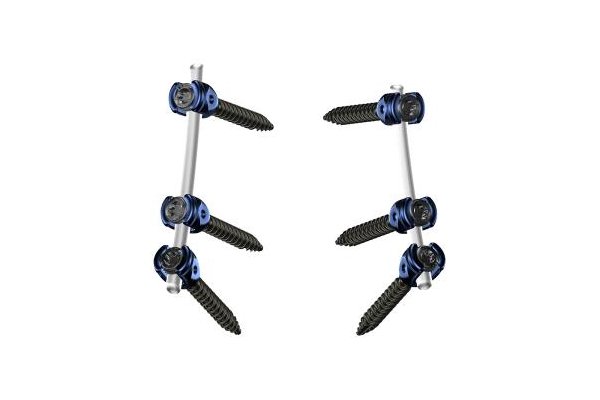 Tiger - Posterior Lumbar - Pedicle Screw System by CoreLink, LLC