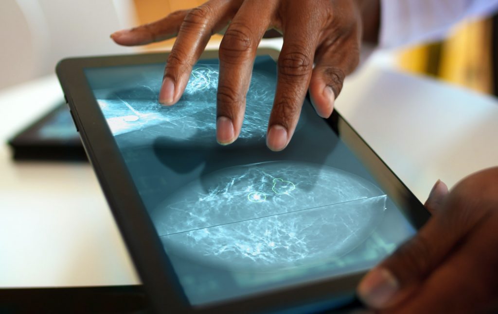 Mia - Triage - Mammography - Case Management Software by ...