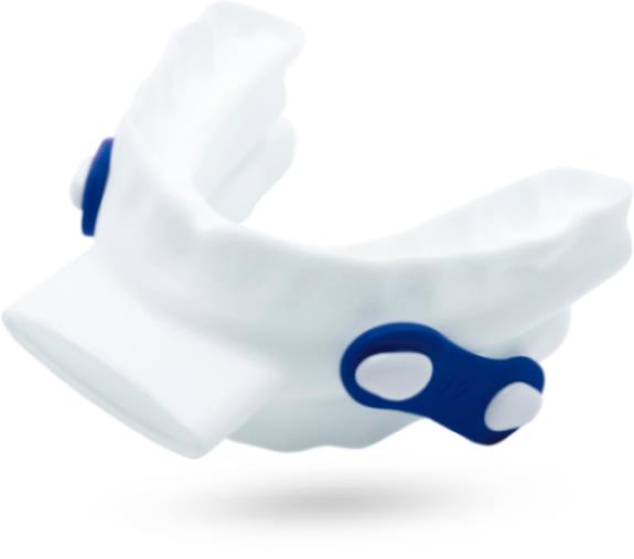O2Vent - Optima - Oral Devices by Oventus