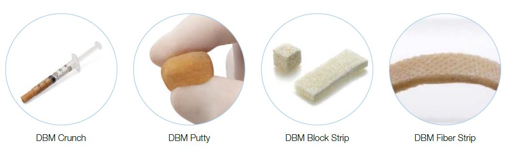 Parametrics - Demineralized Bone Matrix (DBM)