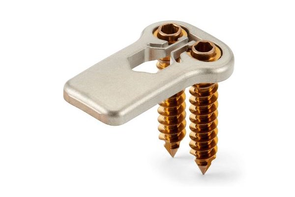 Butrex - Fixation - Anterior Lumbar Buttress Plating System ...