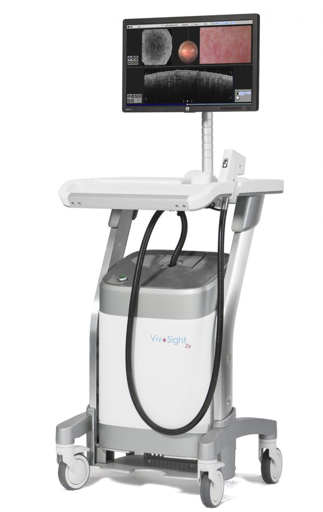 Vivosight - Dx - Optical Coherence Tomography (OCT) System By ...