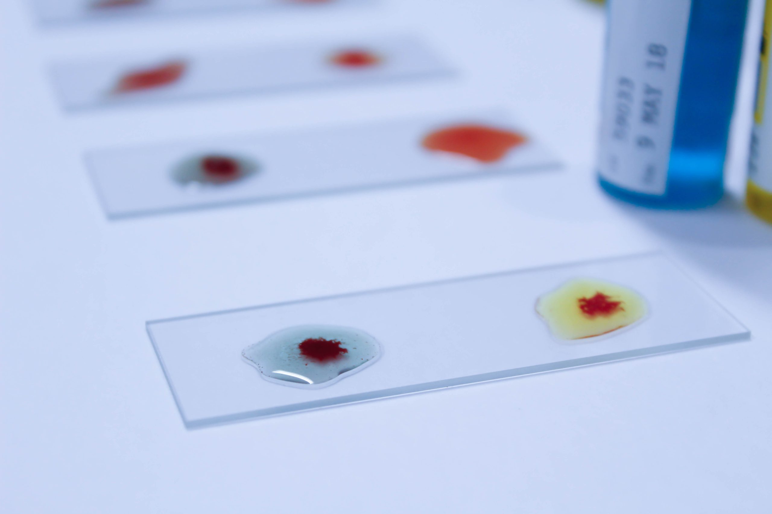 In Vitro Diagnostic Reagents & Assays - Blood Grouping ...