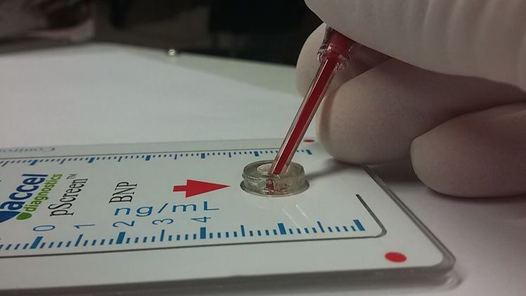 Accel Diagnostics - ADX - Fully Integrated, Molecular Assay ...