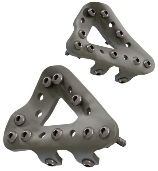 Fusion - Ramus Anatomical Plate (RAP) - Ramus Anatomical ...