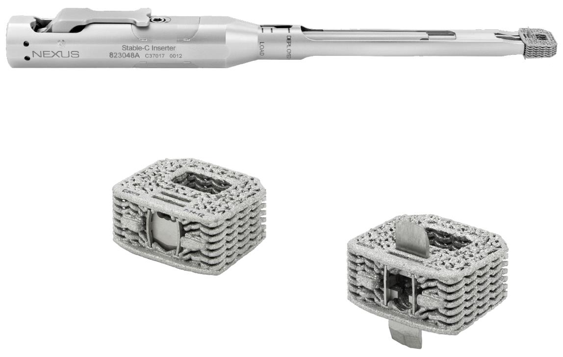 Stable - C - Stable - Anchors by Nexus Spine