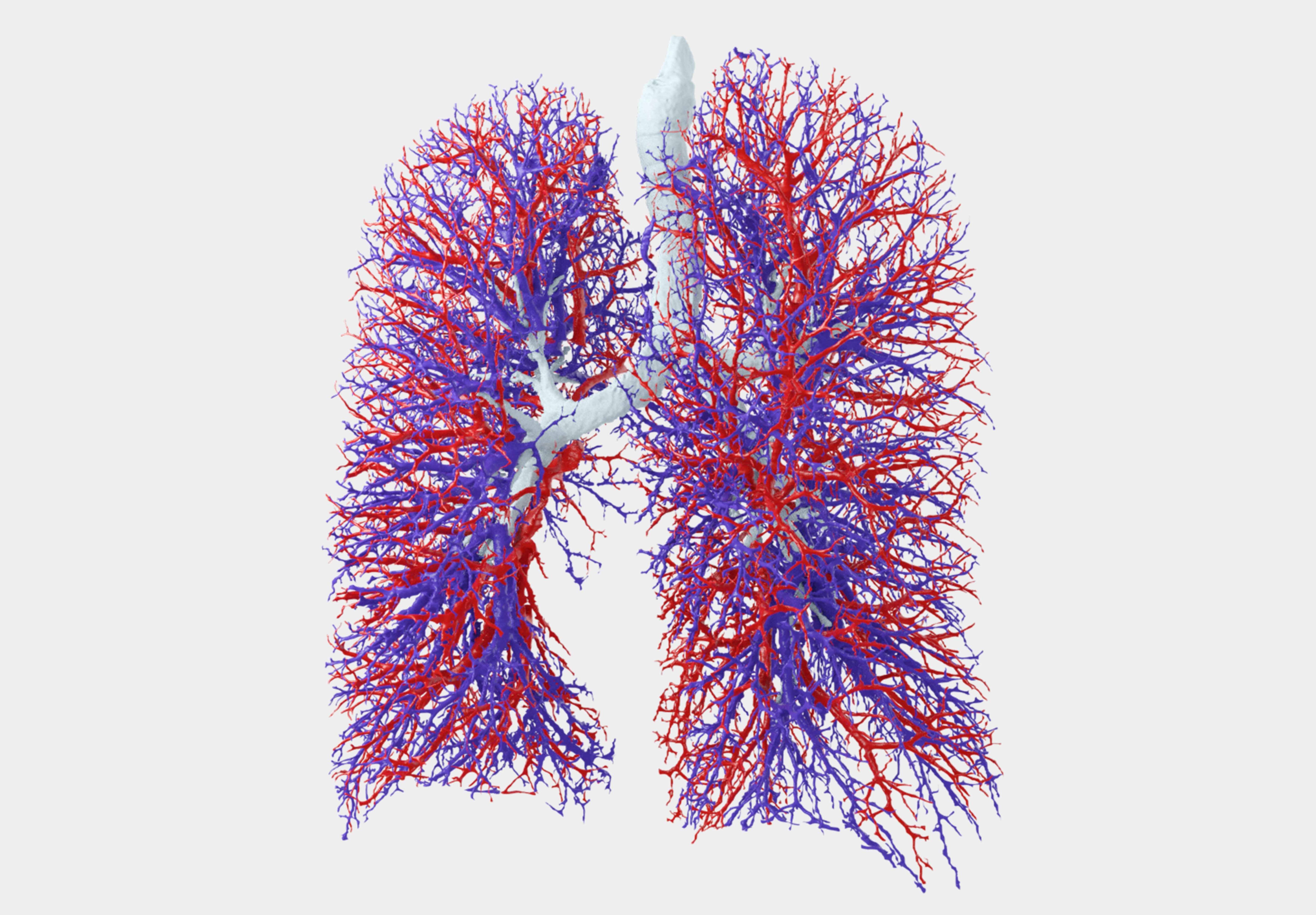 Fluidda Functional Respiratory Imaging (FRI) Technology