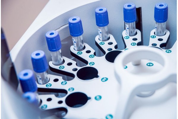 Calder - Protein Engineering Technology by Calder ...