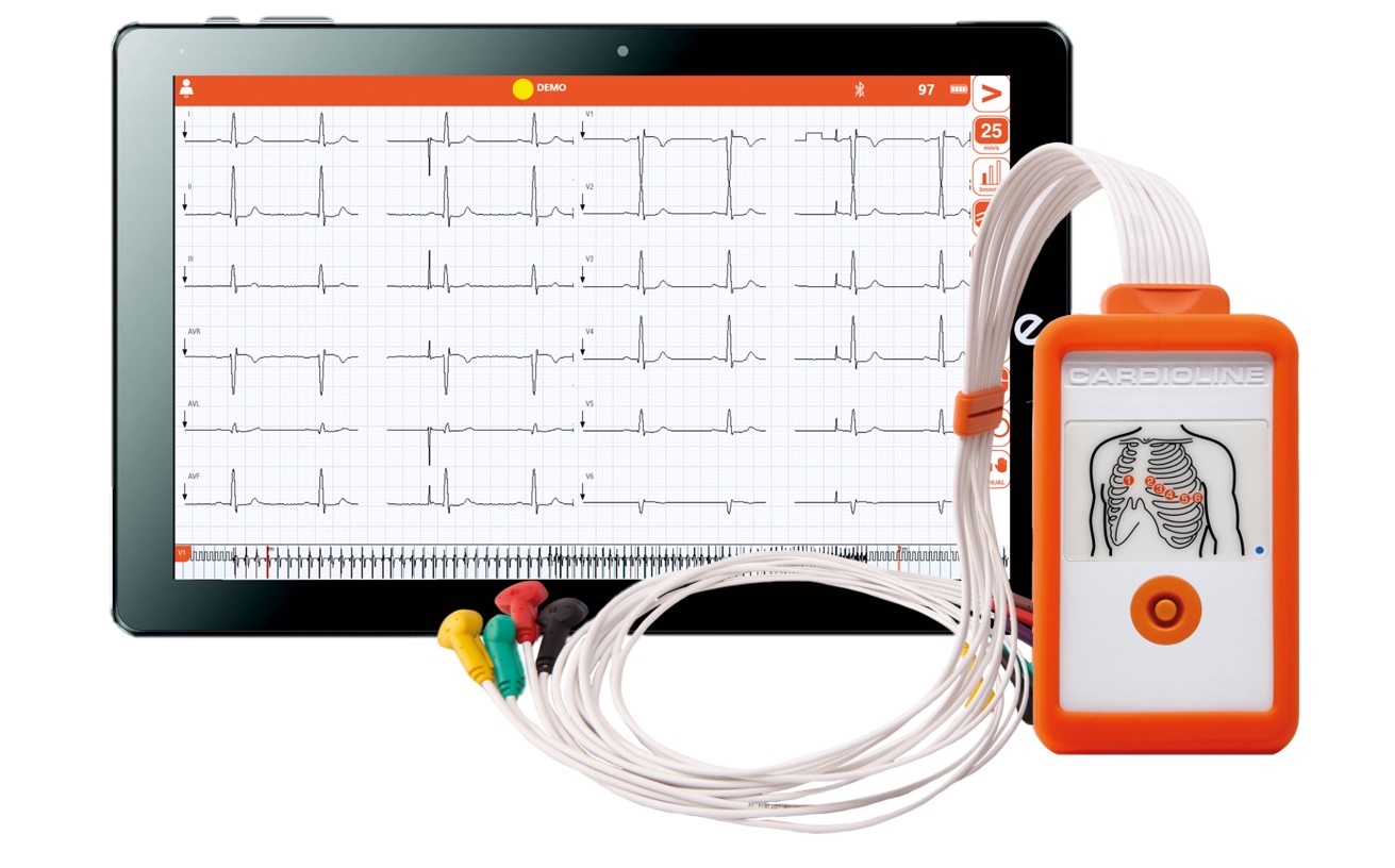 Cardioline - touchECG - Resting ECG Digital Solutions - 12/15 ...