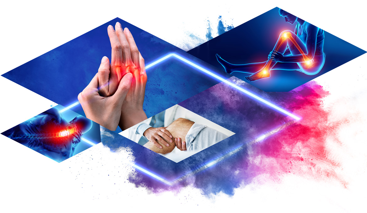 IBSA - Osteoarticular Medicine by IBSA Farmaceutici Italia Srl