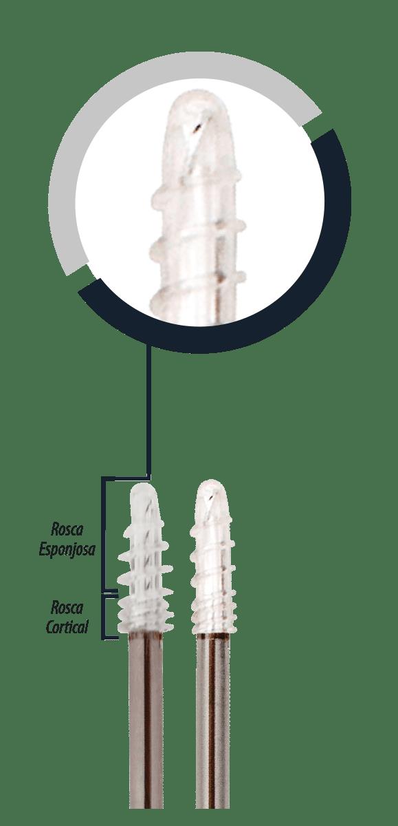 Bioanchor – Plla Resorbable Anchor
