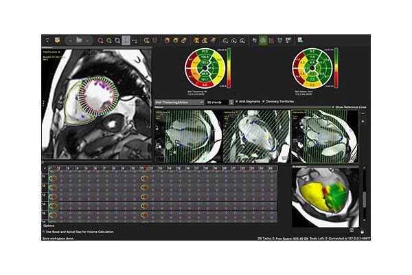 Cvi42 - Cardiovascular MRI By Circle Cardiovascular Imaging Inc.