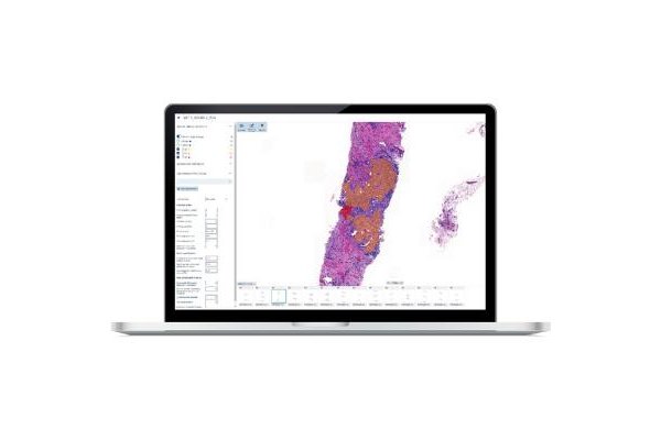 Aiforia - Aiforia Clinical Suites - CE-IVD Marked Clinical AI ...