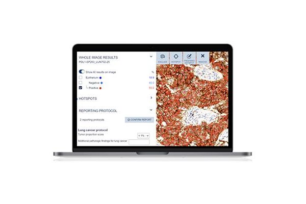 Aiforia - PD-L1 - Aiforia Clinical Suites - CE-IVD Marked ...