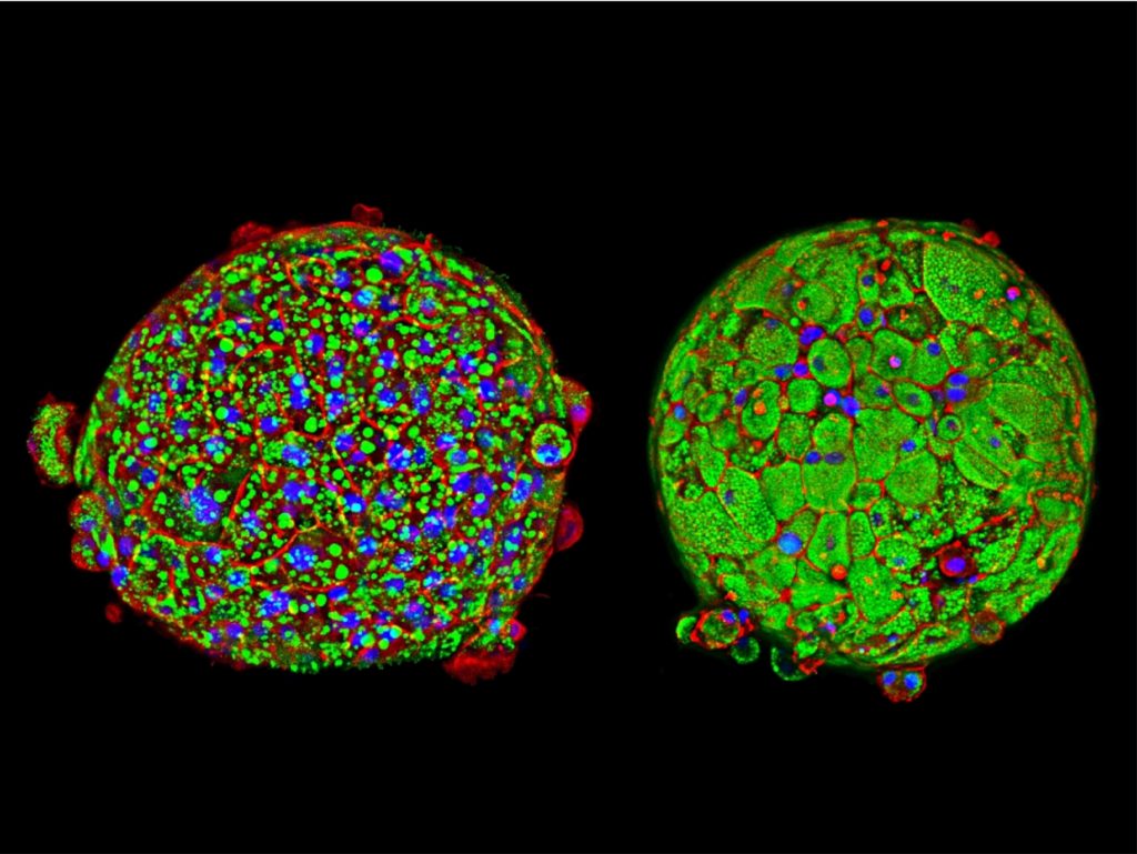 InSphero 3D InSight - NASH - Liver - Liver Disease - Advanced ...
