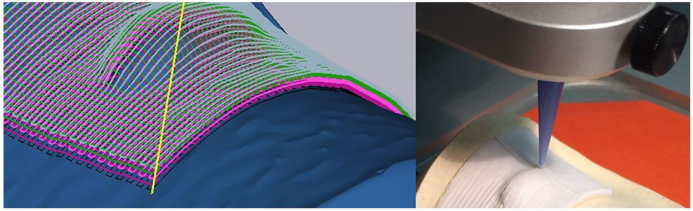 INNOTERE - Medical Devices - Custom-Made Device by INNOTERE GmbH