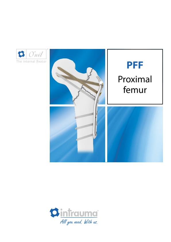 Intrauma - Model PFF - Modular Hook for Treating Proximal Femur Fractures
