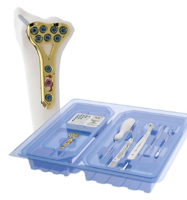 Intrauma - Wristar Multiax - Upper Limb - Volar Plates - Distal Radius ...