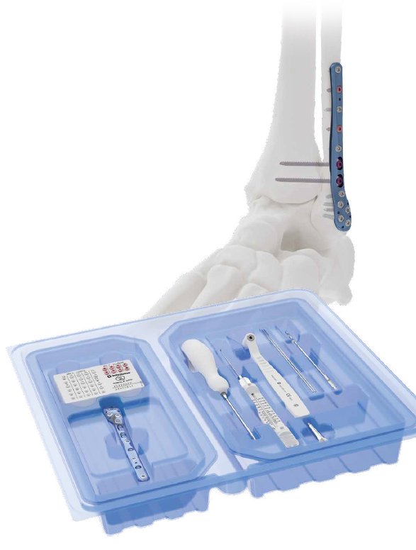 Intrauma - Kite - Lower Limb - Malleolus - Distal Fibula ...
