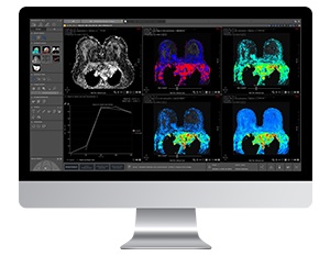 Myrian - XP-Breast - Myrian Clinical Apps - Clinical Apps By Intrasense ...