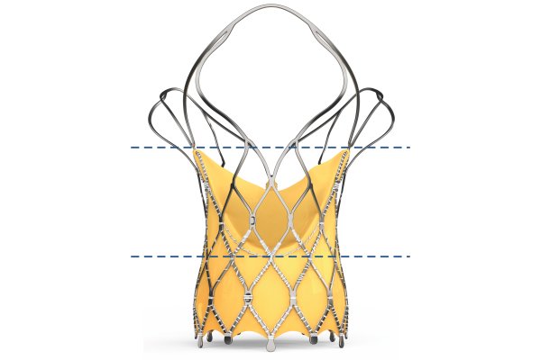 SMT Hydra - THV - Structural Heart Devices - Transcatheter ...