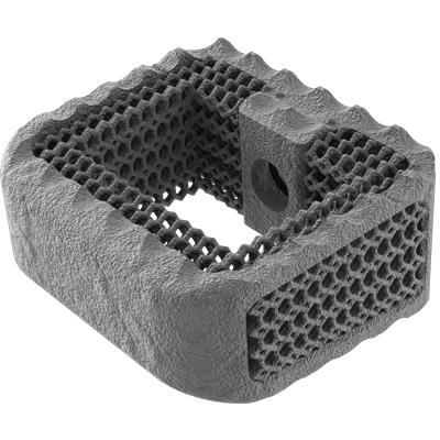 NEXXT MATRIXX 3D Printed Porous Titanium
