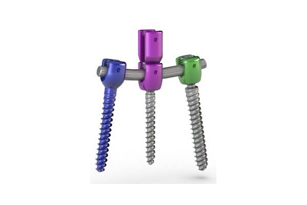 SpineVision - Ulis - Thoraco-Lumbar Fixation - Powerful