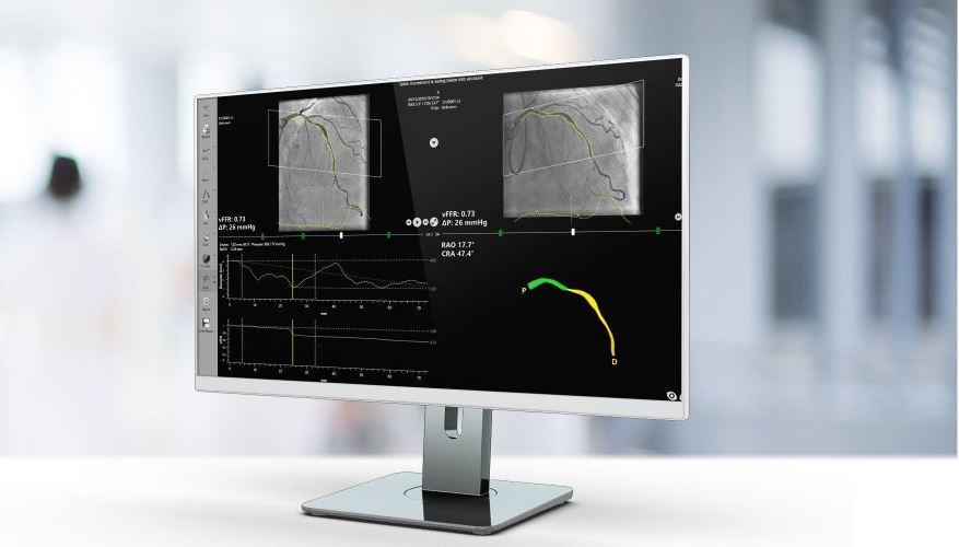 Caas - Vffr - Percutaneous Intervention - Caas Workstation ...