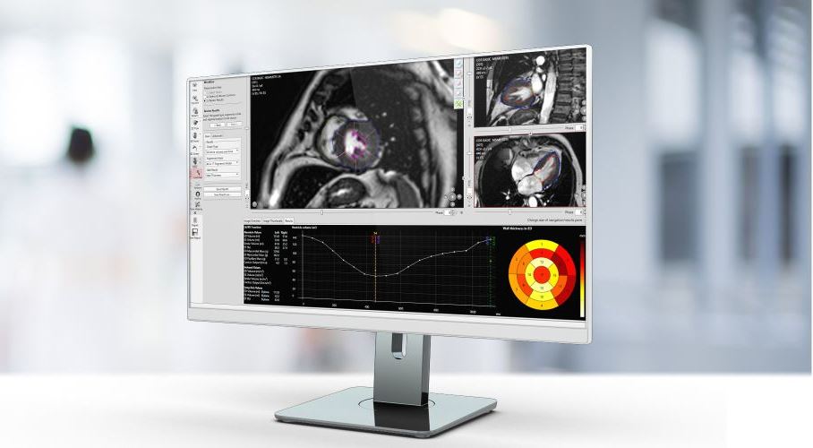 Caas - Cardiac Diagnostics - Caas MR Solutions - Functional ...