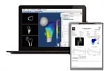 3d-Shaper Dual-Energy X-ray Absorptiometry (DXA) Scan Software