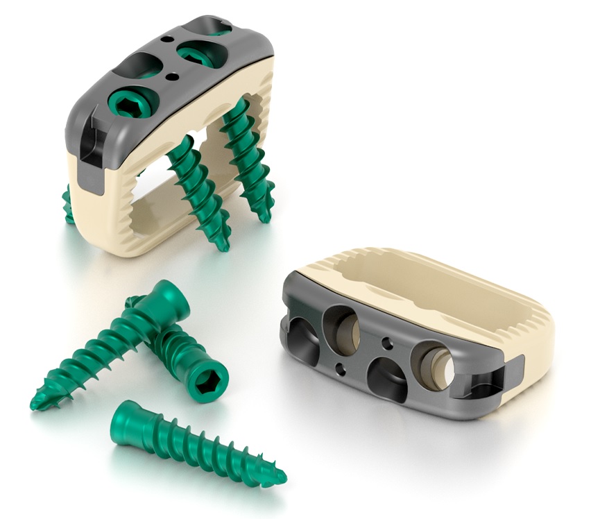 Dyna-Link Elite Stand-Alone Anterior Lumbar System
