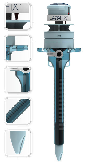 Katsan - 12 Mm - Laparoscopic Instruments - 12 Mm Trocars - Ergonomic ...