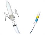 J-Valve TAVI/TAVR Transapical System