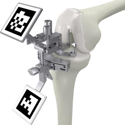 Pixee Knee+ Augmented Reality Navigation Device For Total Knee Arthroplasty
