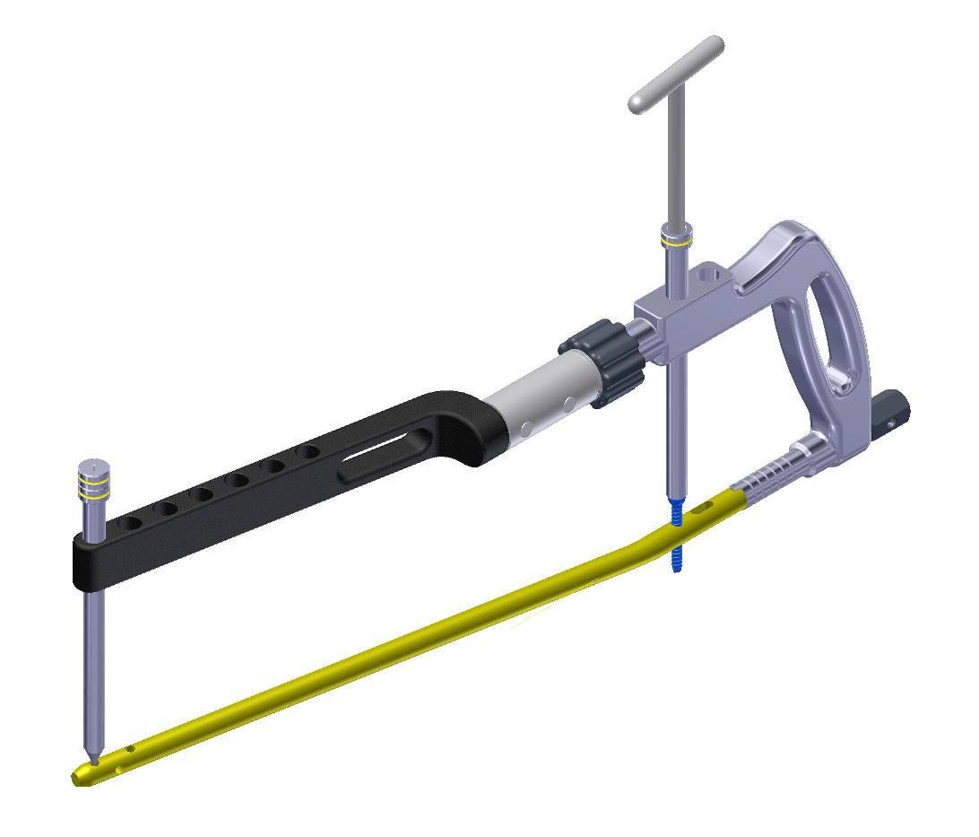 ELORA - Intramedullary Nails - Universal Tibia Nail by ...