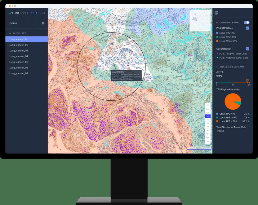 Lunit SCOPE PD-L1 AI Solution For PD-L1 Expression