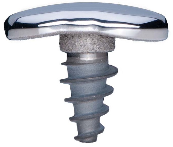 Anika - Unicap & Unicap Small - Arthrosurface Joint Solutions - Knee ...