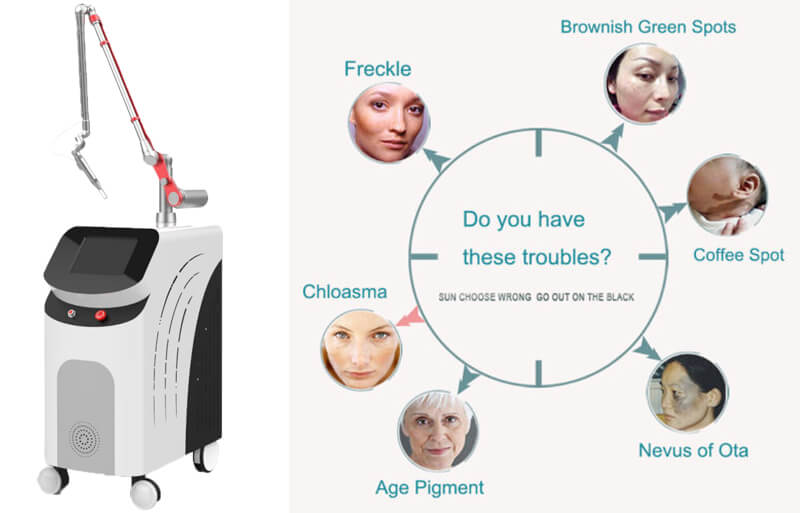 Effectiveness of the picosecond laser and the precautions ...