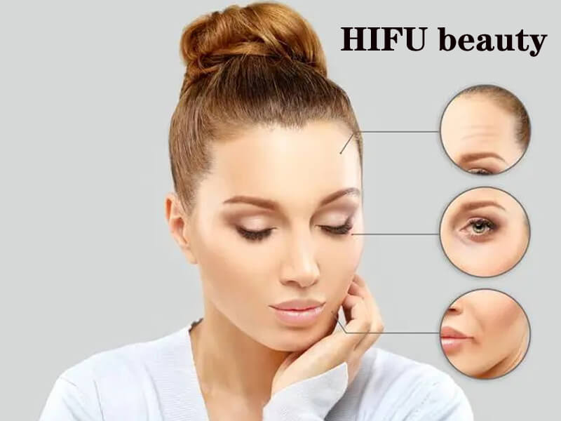 HIFU ultrasound face lifting treatment principles and safety ...